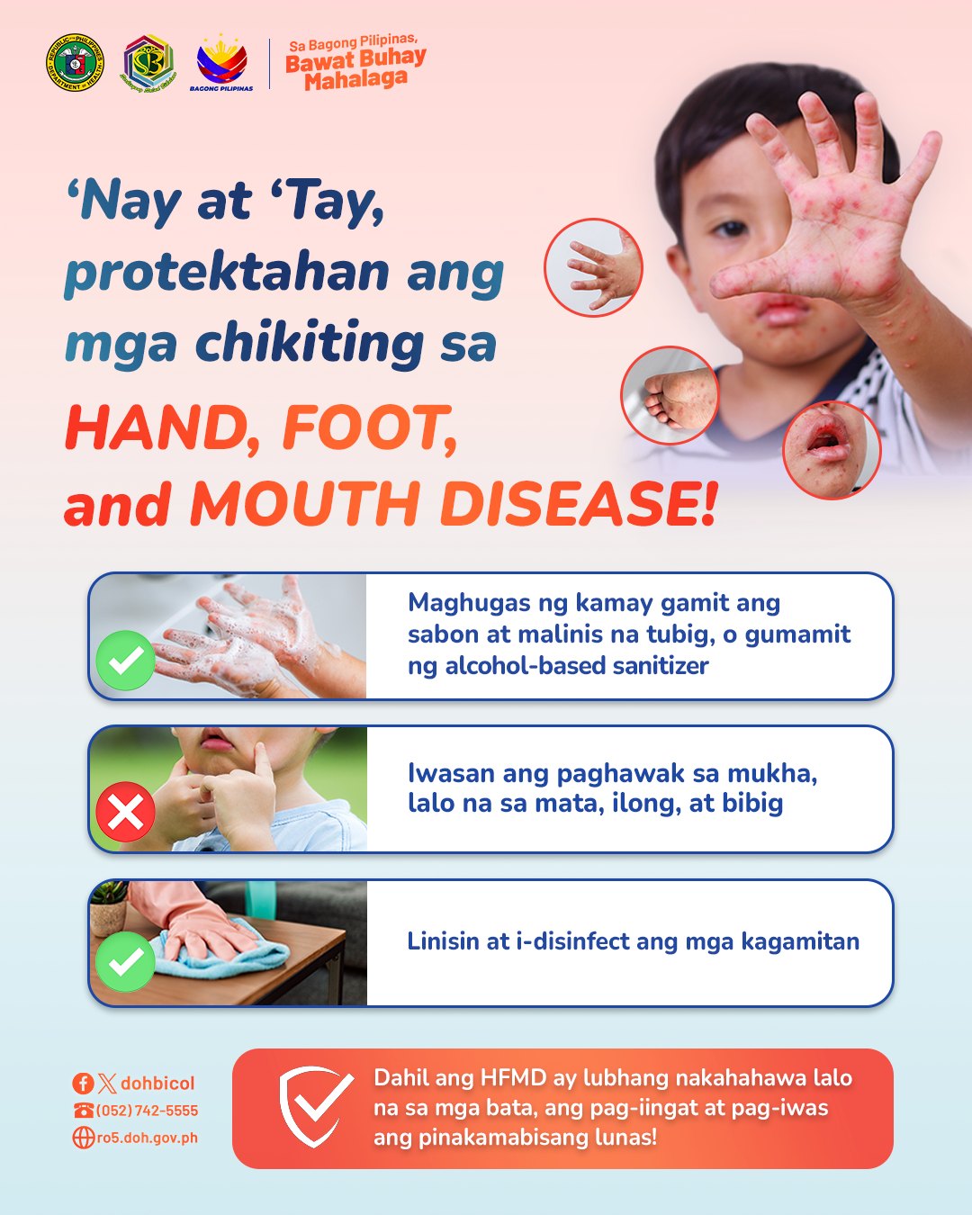 DOH warns vs. HFMD as several preschoolers get infected in Virac ...